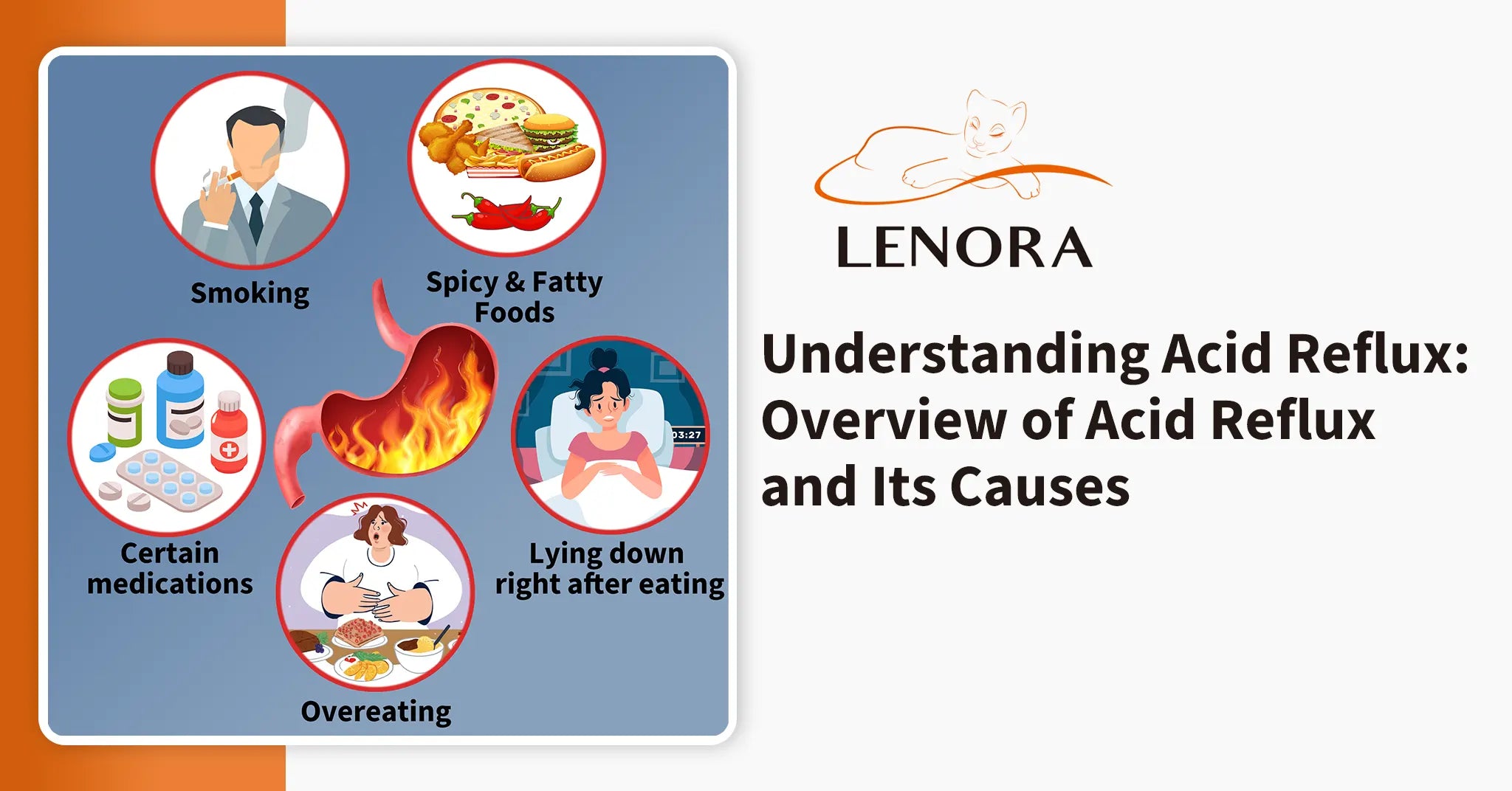 Understanding Acid Reflux: Overview of Acid Reflux and Its Causes – LENORA